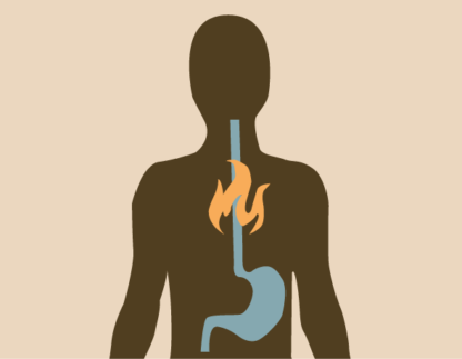 3 Ways to Prevent Coffee Heartburn – Camano Island Coffee